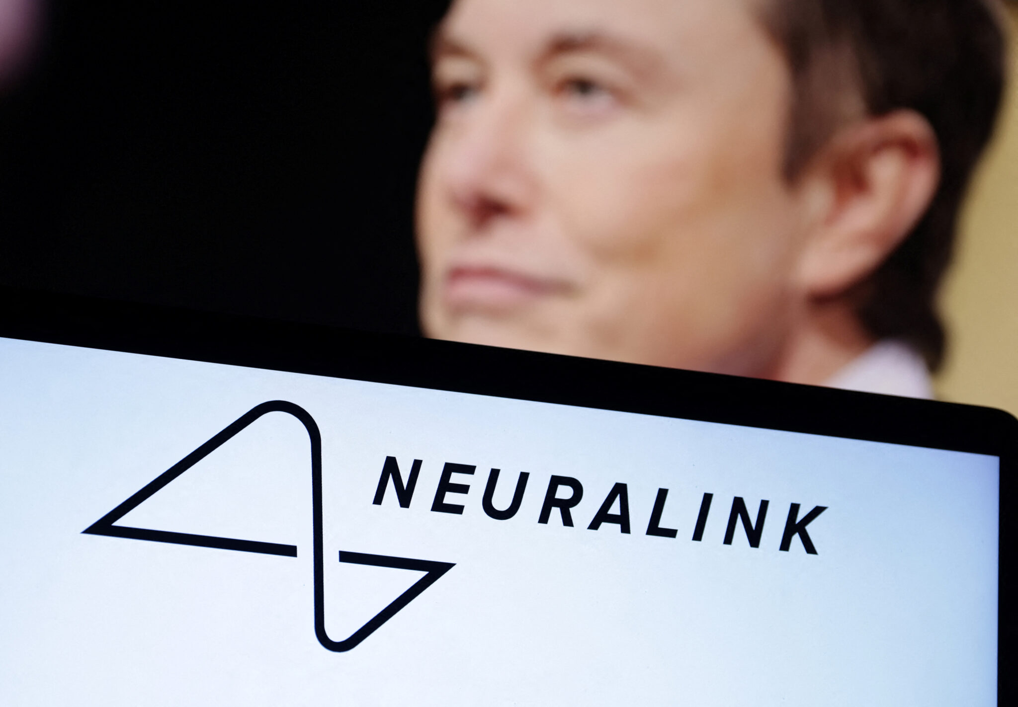 Noland Arbaugh's Journey as the First Human to Have a Neuralink Device ...