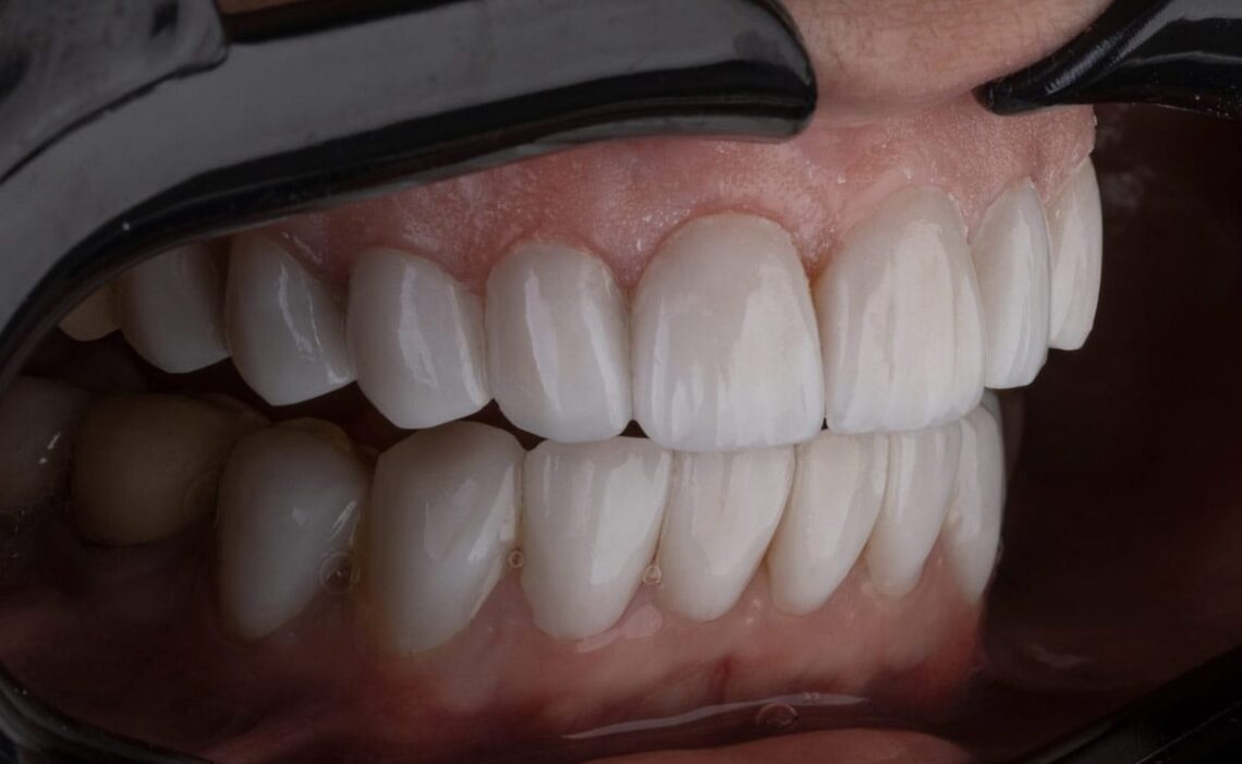 Japan is Launching the World's First Tooth Regrowth Medicine Trials in ...